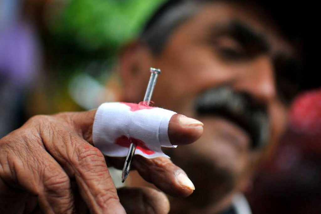 Responsabilidad por falta de medidas de seguridad laborales